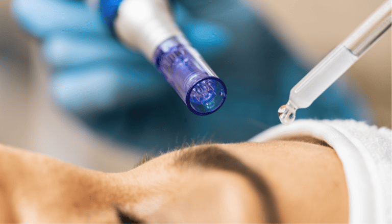How to Get Rid of 11 Lines Without Botox